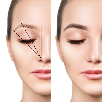 Nose Job Results: How To Get The Nose Of Your Dreams